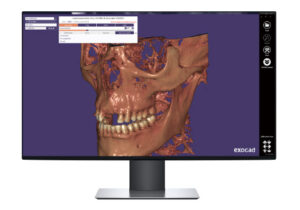 exocad オプションモジュール – コアフロント株式会社