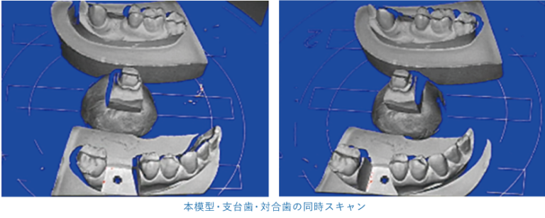 Imetricデンタルスキャナー – コアフロント株式会社