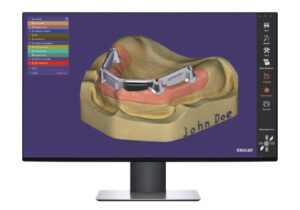 exocad オプションモジュール – コアフロント株式会社