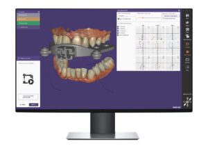 exocad オプションモジュール – コアフロント株式会社