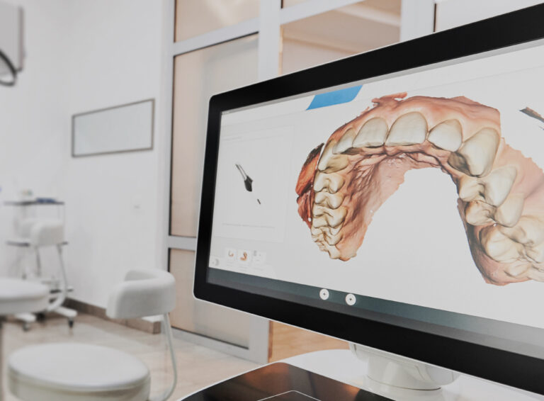 Shape Memory Alignerを始めたいけど、何をそろえたらいいの？ – コアフロント株式会社